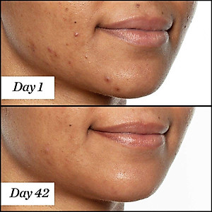 Sunday Riley U.F.O. Ultra-Clarifying Acne Treatment Face Oil 0.5oz