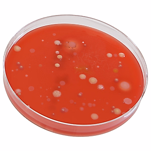 Columbia CNA Agar (Colistin and Nalidixic Acid), with 5% Sheep Blood, for the Selective Isolation of Gram Positive Bacteria, 15x100mm Plate, Order by the Package of 10 plates, by Hardy Diagnostics