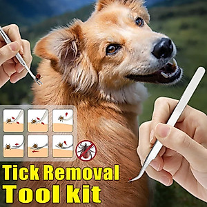 Mrcopetal Tick Remover Tool Kit, Stainless Steel Tick Tweezers + Remover Tick Key, 4 Pack Quick & Safe Tick Twister Removal Tools for Dogs Cats Humans