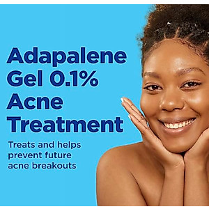 Differin 30 Day Gel & Moisturizer SPF 30 Set, Acne Treatement Gel (15g tube) & MOISTURIZER SPF 30 (2.5 oz), Gentle Skin Care for Acne Prone Skin, Fragrance Free, Non Comedogenic