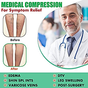 MGANG Compression Socks, 15-20 mmHg Graduated Knee High Compression Stockings for Unisex, Class I, Open Toe, Opaque, Support Hose for DVT, Pregnancy, Varicose Veins, Relief Shin Splints, Beige L