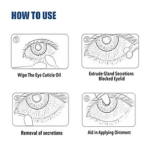 Meibomian Gland Expressor Dry Eye Relief Eyelid Gland Care Clean Tools Kit Eye Stye Treatment Chalazion Remover Meibomian Gland Forceps Titanium Alloy Eyelid Massage Tweezers (Sterile)