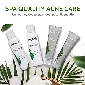 Exposed Skin Care Basic Acne Treatment Kit - Includes Salicylic Acid Face Wash, Clearing Tonic, Acne Treatment Serum with Benzoyl Peroxide, Clear Pore Serum - Acne Set Solution for All Skin Types