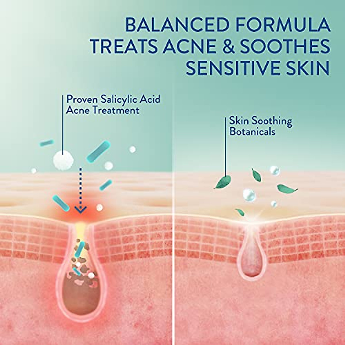 Cetaphil Acne Face Wash, Gentle Clear Clarifying Acne Cream Cleanser with 2% Salicylic Acid, Deep Cleans & Treats Acne Prone Skin, Skin Care for Sensitive Skin, 4.2oz