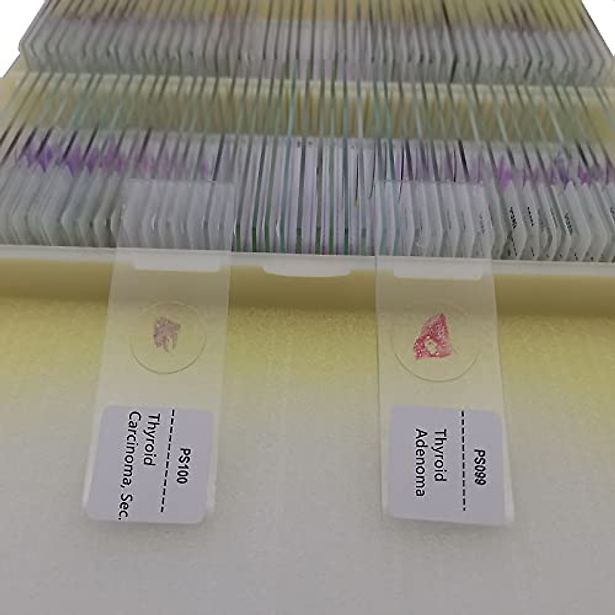 Human Pathological Section Prepared Tissue Specimen Slides 100pcs/box