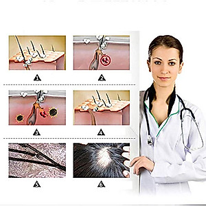 5 PACK Hair Growth Serum Liquid Hair Loss Treatment for Women & Men Dense Thicken Hair