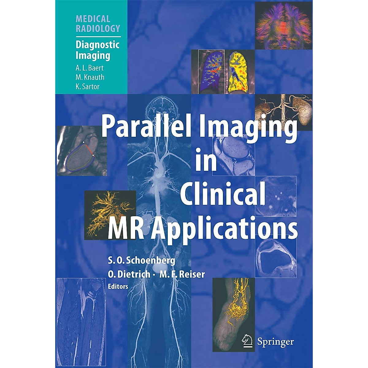 Parallel Imaging in Clinical MR Applications (Medical Radiology)