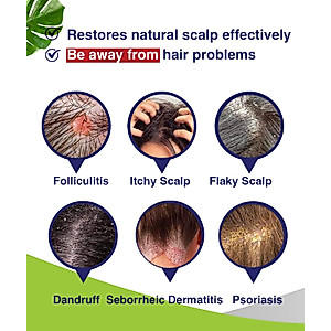 PHARMBANNER Anti-Fungal Shampoo for Folliculitis, Seborrheic Dermatitis, Scalp Psoriasis - Relieves Itchy & Dry Scalp