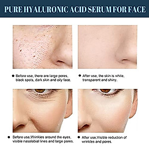 Proform Korean Soluble Protein Thread, Absorbable Collagen Thread for Face Lift, Nano Gold Soluble Protein Thread Strips, Soluble Protein Thread Lifting Instant Face Protein Thread (60PCS)