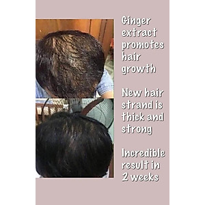 WEILAIYA White Ginger Prevent Hair Loss Shampoo 14g and Conditioner 14g Mini sample/travel/test try set for Normal/Oily Hair & Scalp