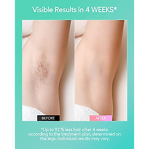 INNZA IPL Hair Removal Device for Women and Men at Home,Permanent Hair Remover Machine,10 Energy Levels,24J High Energy Hair Removal Handset for Face Bikini Line Armpit Leg Back,Corded