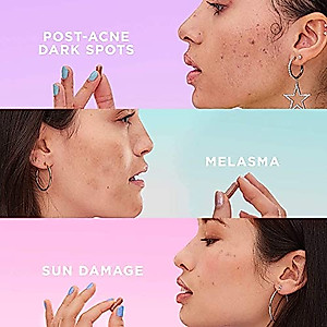 ZitSticka Vitamin Acne Supplement for Cystic Acne w/ 30 Natural Caps for Women and Men, Supplements for Hormonal Support, Skin Clarity, Dark Spots - Dermatologist Tested (Blur Potion™)