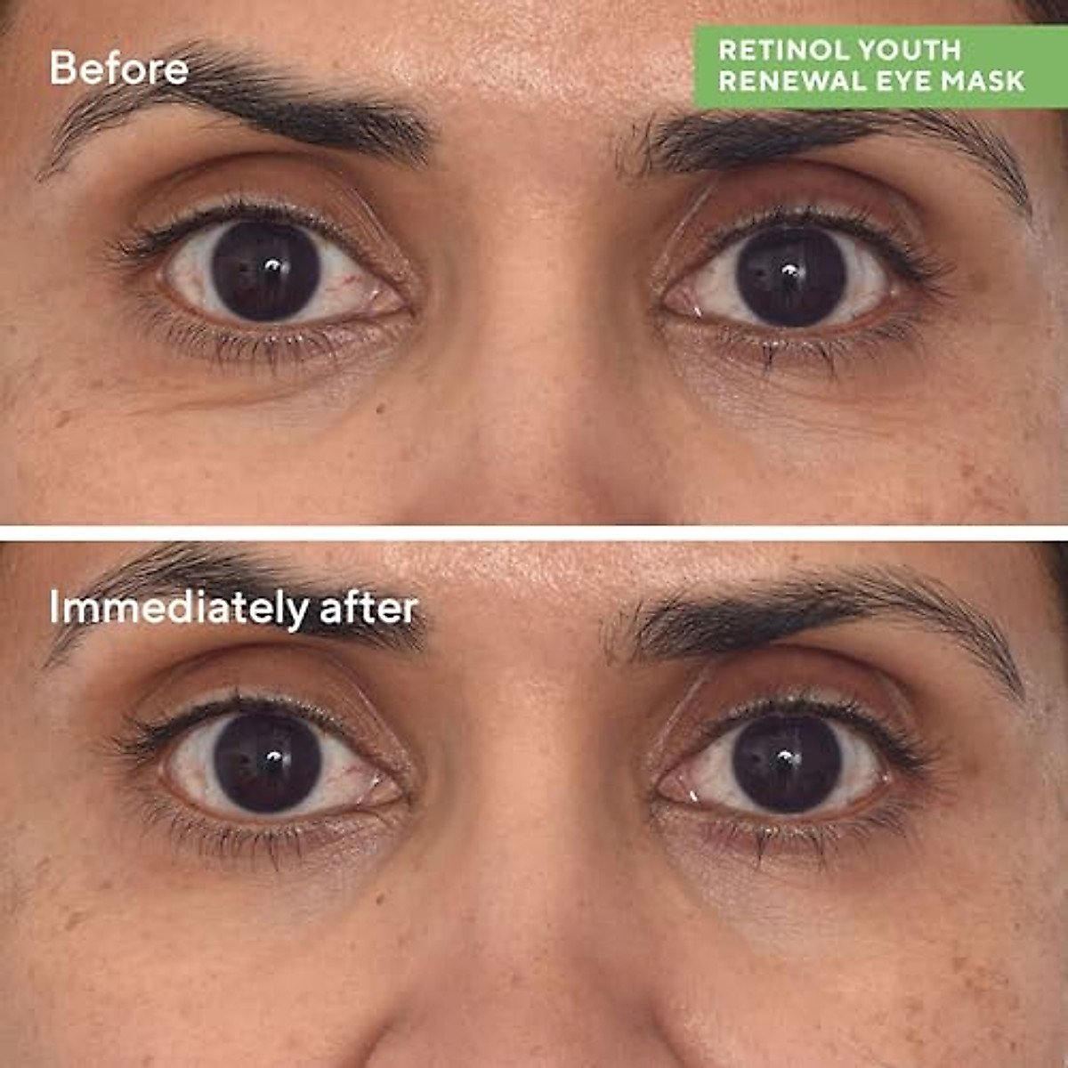 Murad Dr. Zion Retinol Youth Renewal Eye Masks – No-Slip Under Eye Patches for Fine Lines, Wrinkles, Crow’s Feet and Puffy Eyes - Full Absorption Treatment Strips, 5 Pairs