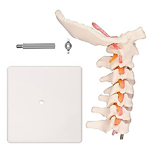 Ultrassist Cervical Spine Model with Cervical Vertebrae, Cervical Nerves, Vertebral Arteries & Occipital Plate for Medical Education