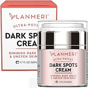 Lanmeri Dark Spot Remover for Face and Body, Dark Spot Corrector Fade Cream, Age Spot, Brown Spot, Sun Spot & Freckle Remover for Face, Hands and Other Body Areas, for Both Women and Men, for All Skin Types