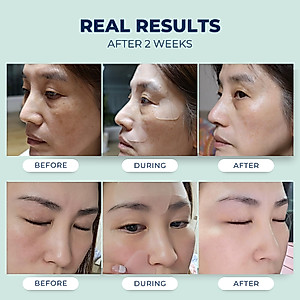 PETITE PLUIE 50 PCS Wrinkle Patches For Face - Overnight Korean Face Lift Tape with Hydrolyzed Collagen, Hyaluronic Acid and Peptides - Made in Korea