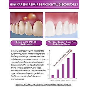 Medicine Toothpaste Healing Early-Mid Periodontitis Treatment at Home, Gum Repair for Receding Gums, Gum Disease & Gingivitis Treatment, Periodontal Disease Treatment Hydroxyapatite Toothpaste, 3.52OZ