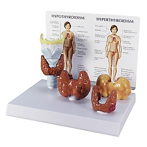 Thyroid Model Set | Human Body Anatomy Replica of Thyroid w/Diseases for Doctors Office Educational Tool | GPI Anatomicals