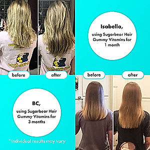 Sugarbear Hair Vegan Vitamin Gummies for Normal Hair Growth Vitamin C, Biotin, B12, Zinc, Iodine, Folic Acid, Coconut Oil, Hair and Nails Supplement for Women & Men 75ct(1 Month Supply + 7 Bonus Days)