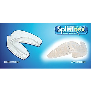 Professional Teeth Mouth Guards for Teeth Grinding and Clenching - Dental Protectors for Bruxism - 4 Pack - BPA Free - Multi Use - Free Storage Case