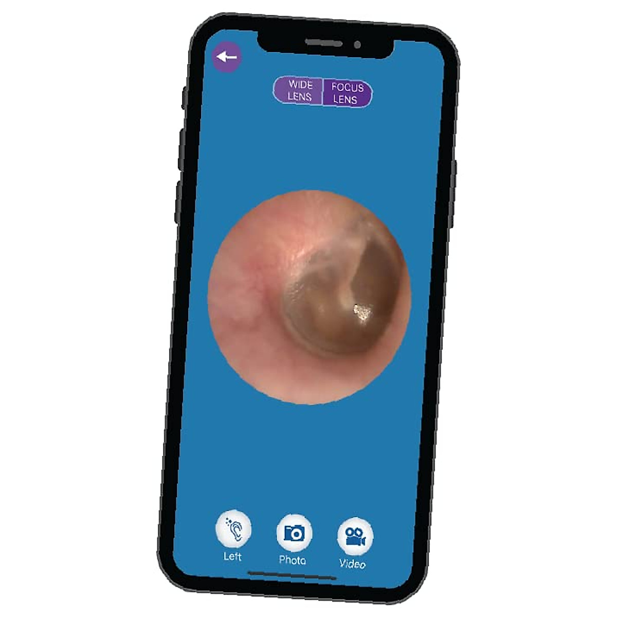 Ear View MD, Wi-Fi Ear Camera