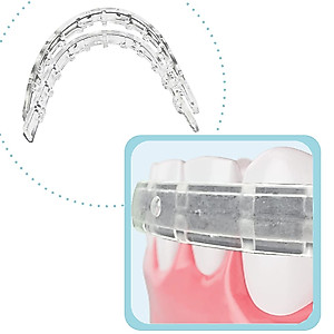 Comfort Cover for Braces, Lip Protector Mouth Guard Lip Cushion Teeth Shield Bumper for Brackets, Aligner, Dental Wax Alternative, Hard and Rigid Clip