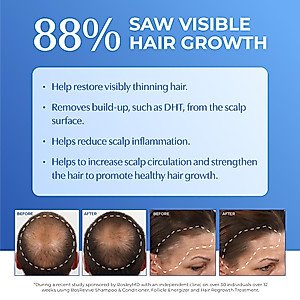 BosleyMD BosRevive KIT for Visible Hair Thinning (Non Color-Treated), Starter Size (30 Days)