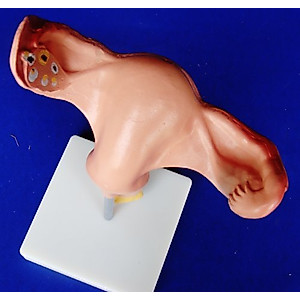 Model Anatomy Professional Medical Uterus Magnified New IT-086 ANGELUS