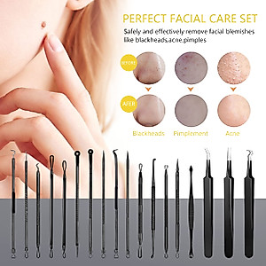 19 Pcs Blackhead Remover Pimple Popper Tool Kit,Professional Blackhead Extractor Tool for Nose Face, Stainless Comedone Extractor, Blemish Whitehead Popping Tool with Portable Metal Case (Black)