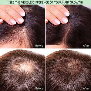 Rice Water For Hair Growth, All Natural Vegan Leave in Conditioner Spray Hair Care Products for Woman&Men, Biotin Infused Leave In Conditioner. Rice Water Hair Mist For Dry, Frizzy, Weak, Damaged Hair - Strengthen, Moisturize & Thicken Hair Naturally - 4o