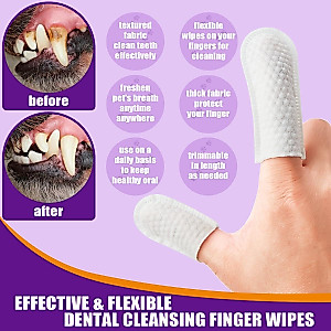 WALLZON Teeth Cleaning Finger Wipes for Dogs & Cats, Soft Pet Dental Care Wipes, Disposable Pet Tooth Brushing Wipes, Gentle Cleaning & Gum Care Finger Pet Wipes (100 Wipes)