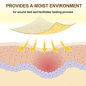 Ceeport Manuka Honey Calcium Alginate Wound Dressing, 2"x 2" High Absorbency Honey Wound Dressing with Calcium Alginate, Medical Grade Manuka Honey Wound Care Bandages Patches for Wounds(Pack of 10)