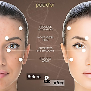 PURA D'OR 4 Oz Organic Tamanu Oil - USDA Certified 100% Pure & Natural Cold Pressed Carrier Oil, Premium Grade Moisturizer Helps Reduce Appearance of Scars & Wrinkles - For Skin & Hair - Men & Women