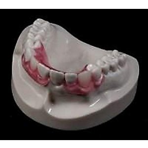 "Nesbit bridge" , Flipper Uppler and Lower Set of Affordability Flexible Valplast Customized Partial Denture (Pink, Valplast)