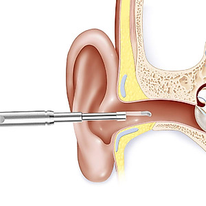 Teslong Otoscope Accessories: 9 Disposable Speculums, 4 Ear Picks, 1 Pack of Q-Tips, Accessories for NTE100i Ear Camera Ear Scope, 0.16 inch or 4.3mm Dia.