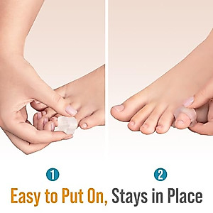 5 STARS UNITED Toe Spacers for Men and Women – 4 Gel Pinky Toe Separators for Curled and Overlapping Toes, Bunions, Hammer Toe Straightener, Little Toe Spreader