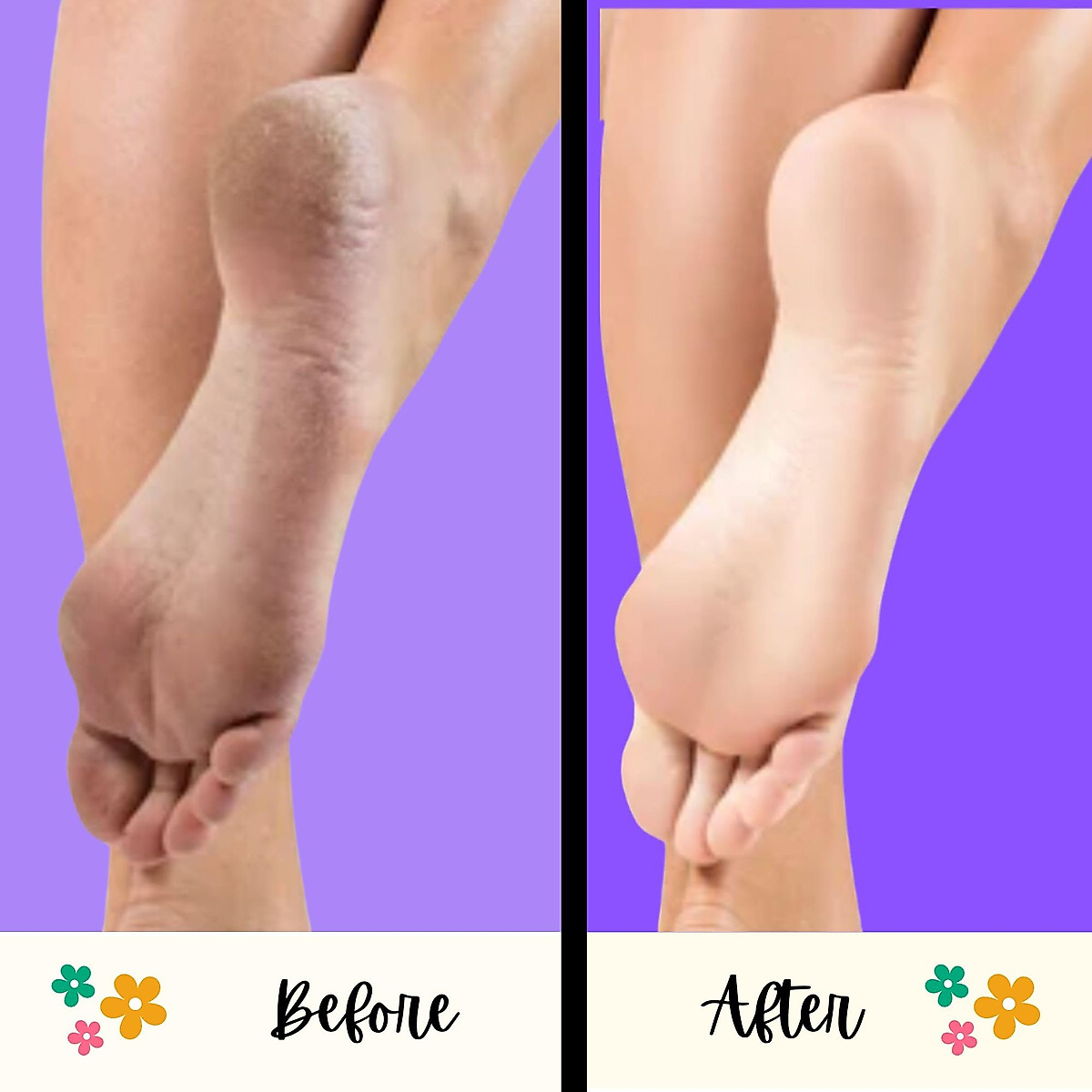 Mr. Pumice Ultimate PUMI Bar: 2-in-1 Dual-Grit (Medium + Coarse) Callus Remover, Pedicure Stone & Ped File Scrubber for Smooth Feet and Heels, (12-Count Display Box)