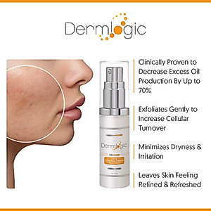 Dermlogic Acne Face & Body Cream- Maximum Strength Treatment for Cystic, Blackhead & Whitehead Pimples. Prevents Future Breakouts.