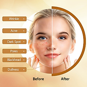 POP MODERN.C Kojic Acid Soap Turmeric Soap for Face and Body Vitamins C Soap for Acne Blackheads Christmas Gifts 2x100g Soaps 1pc Mesh Soap Pouch and Wooden Soap Holder