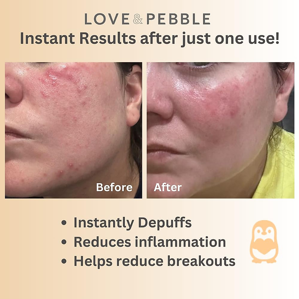 Beauty Pops by Love & Pebble- Turmeric Mask Glow Enzyme Icy Facial Kit| Viral On TikTok| As seen on Shark Tank beauty | Korean Face Mask Skincare made with turmeric, aloe, banana, papaya