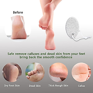 Natural Foot Pumice Stone for Feet, Borogo 2-Pack Lava Pedicure Tools Hard Skin Callus Remover for Feet and Hands - White&Red