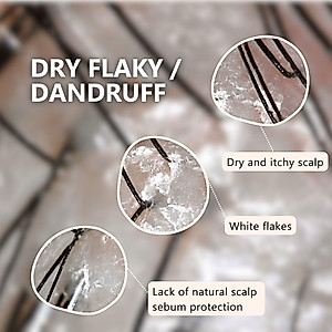 Aromase Soothing Shampoo for Dry, Itchy, and Flaky Scalps – designed to relieve scalp itchiness and provide lasting comfort gently.