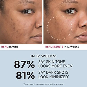 IT Cosmetics Bye Bye Dark Spots 4% Niacinamide Serum - Visibly Reduces Dark Spots & Improves Skin Clarity In 8 Weeks - With 1% Ethyl Vitamin C - For All Skin Types - 1 fl oz