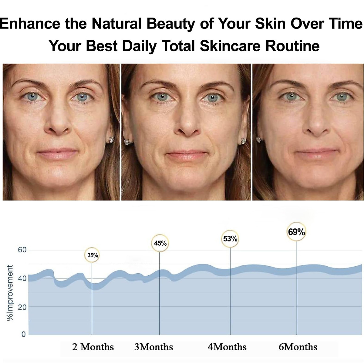 Angel Kiss Light Beauty Mask - Led Face Mask Light Therapy - Red Light Therapy Mask for Face - LED Facial Skin Care Mask