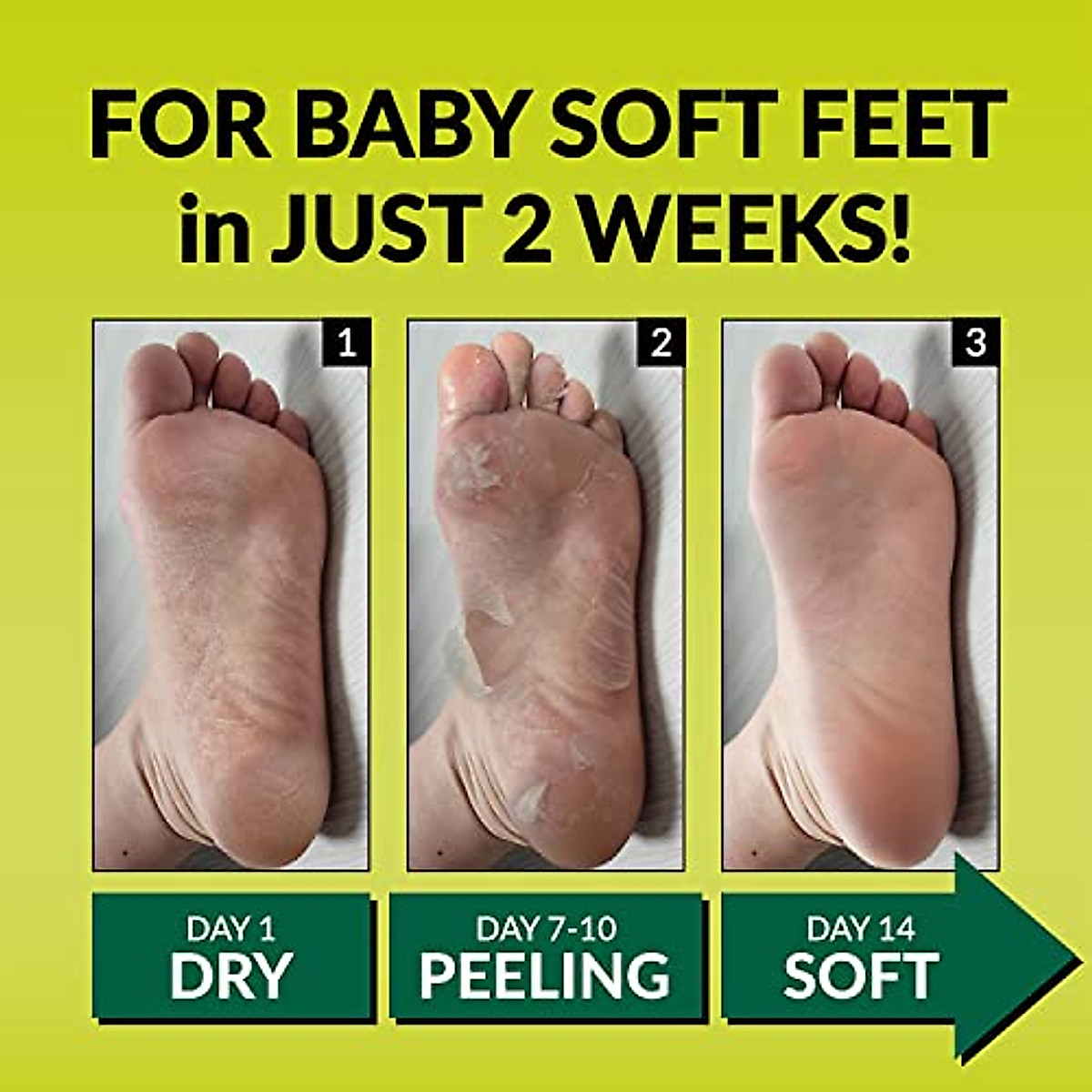 FARMSKIN Foot Peel Mask Clearing / Removes Dry Dead Skin for Cracked Feet / foot mask for soft baby feet with Tea Tree, Cica / Dermatologically Tested (Pack of 3)
