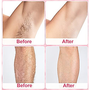 Wax Roller Kit for Hair Removal,Roller Waxing Kit,Roll On Wax Kit For Hair Removal Sensitive Skin,Roll On Wax Kit For Face,Arms, Legs And Larger Areas Of The Body Hair Removal,Roll on Wax Warmer Kit