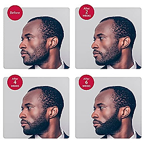 Godefroy Thick Beard and Mustache Growth Serum For Ethnic Hair Types, 15 ml