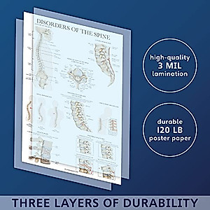 Palace Learning 2 Pack: Anatomy of the Spine + Disorders of the Spine Poster Set - Set of 2 Anatomical Charts - Laminated - 18" x 24"