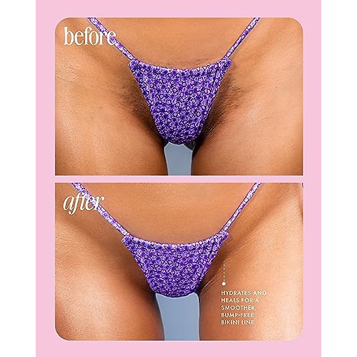 Truly Beauty Cooka Concentrate Ingrown Serum - Ingrown Hair Treatment for Bikini Area - Smoothing and Soothing After Shave Formula - Heals Razor Burn, Nicks, and Ingrowns - 0.7 OZ