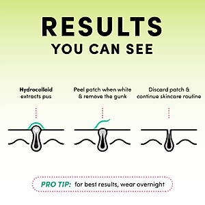 Dots for Spots Pimple Patches - Fast Acting Translucent Hydrocolloid Zit Treatment Stickers for Face - Blemish Patch for Women, Men & Teenagers - Made in Korea (60 count)